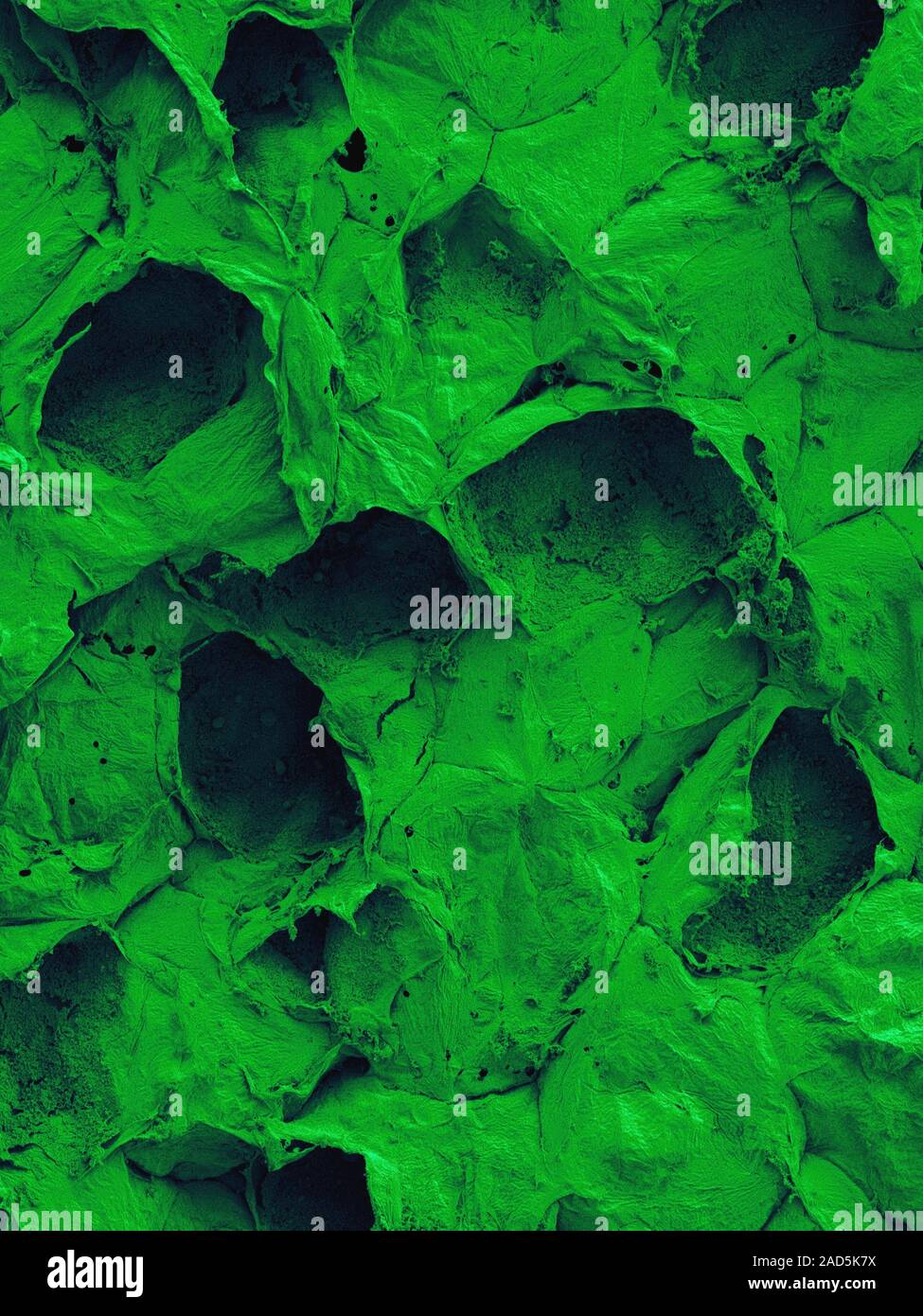 Green bean inner bean pod parenchyma cells after steaming (Phaseolus ...