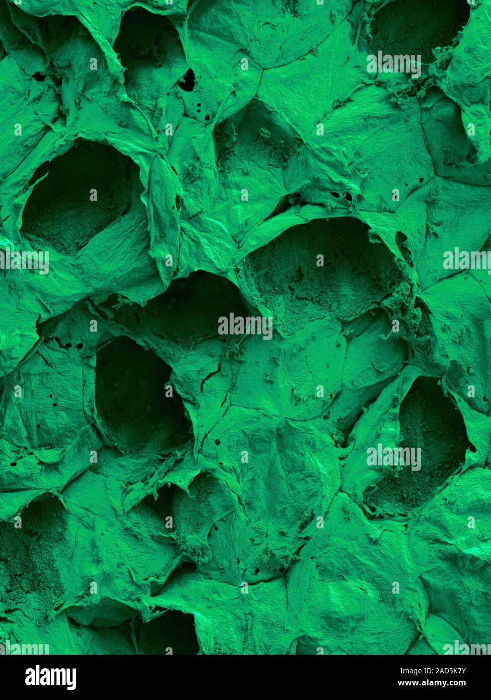Green bean inner bean pod parenchyma cells after steaming (Phaseolus ...