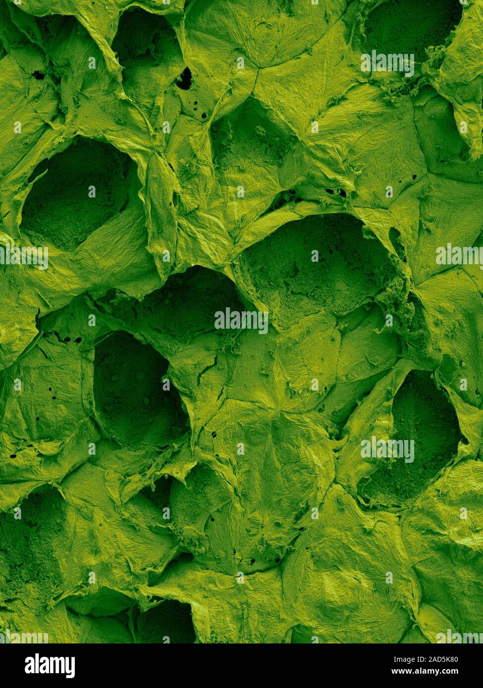 Green bean inner bean pod parenchyma cells after steaming (Phaseolus ...