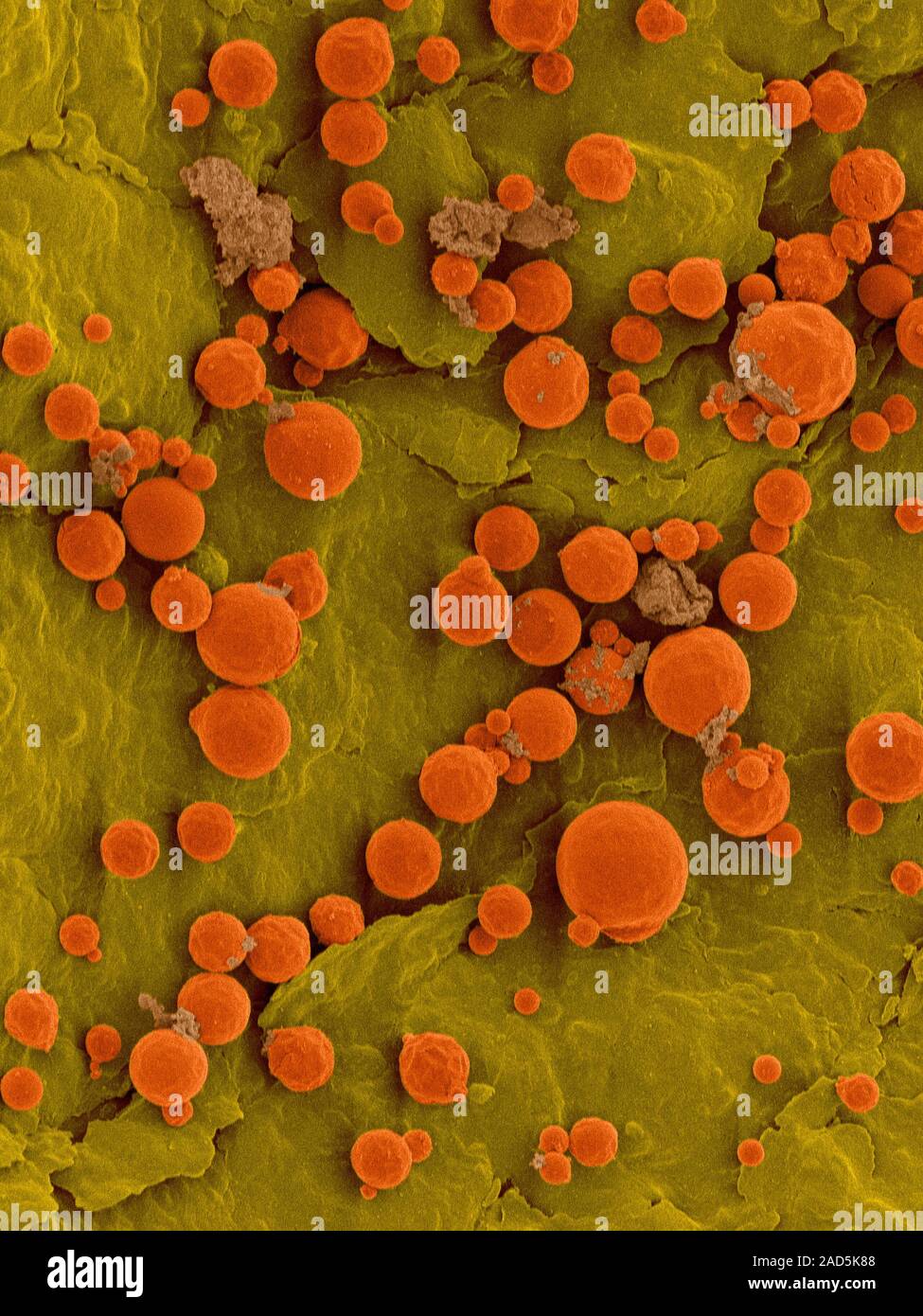 Surface of a lemon peel with yeast cells (Citrus limon), coloured ...