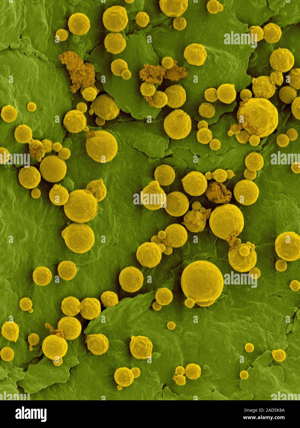 Surface of a lemon peel with yeast cells (Citrus limon), coloured scanning electron micrograph ...