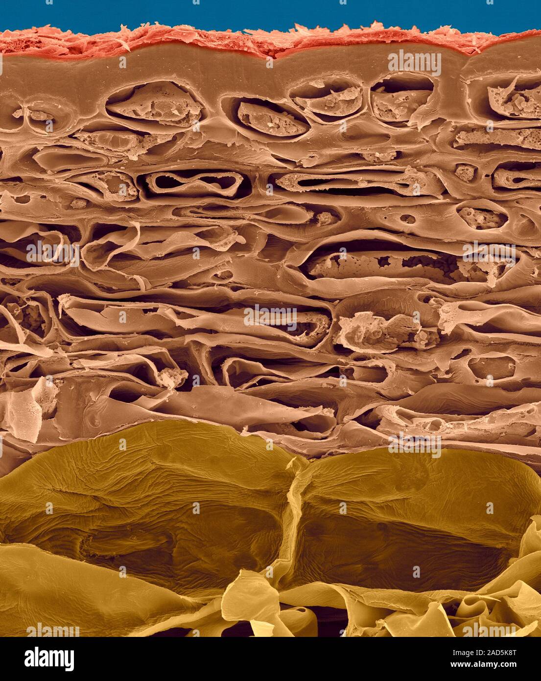 Apple fruit section, skin to parenchyma cells (Malus domestica ...
