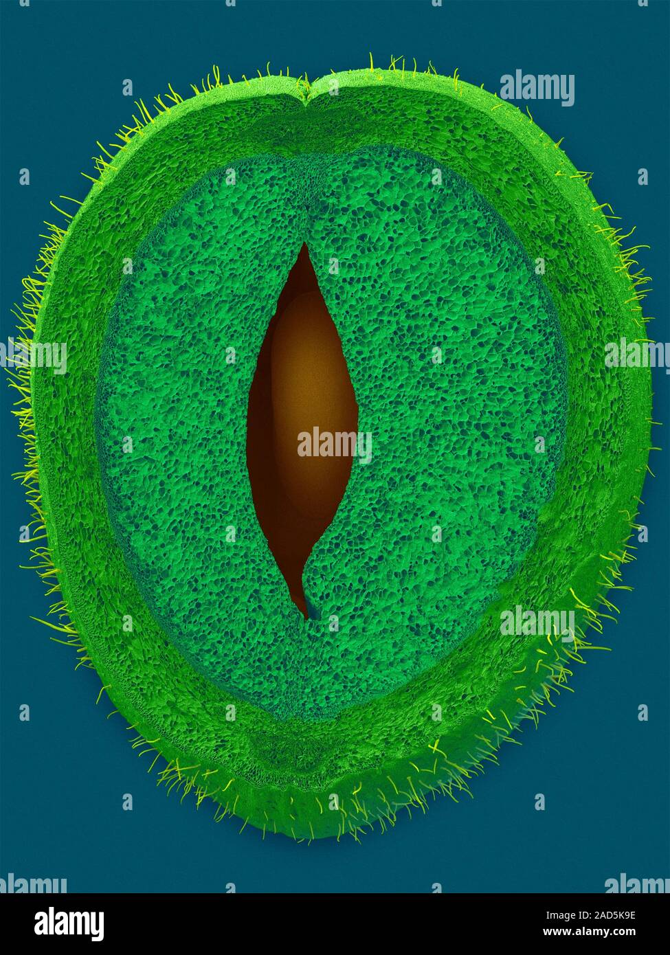 Green bean pod parenchyma cells and seed (Phaseolus vulgaris; Blue Lake ...