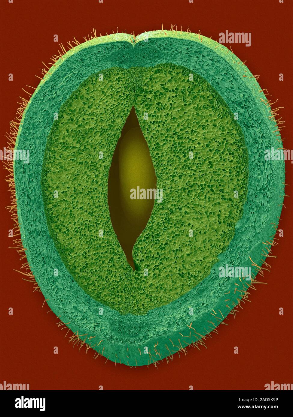 Green bean pod parenchyma cells and seed (Phaseolus vulgaris; Blue Lake ...