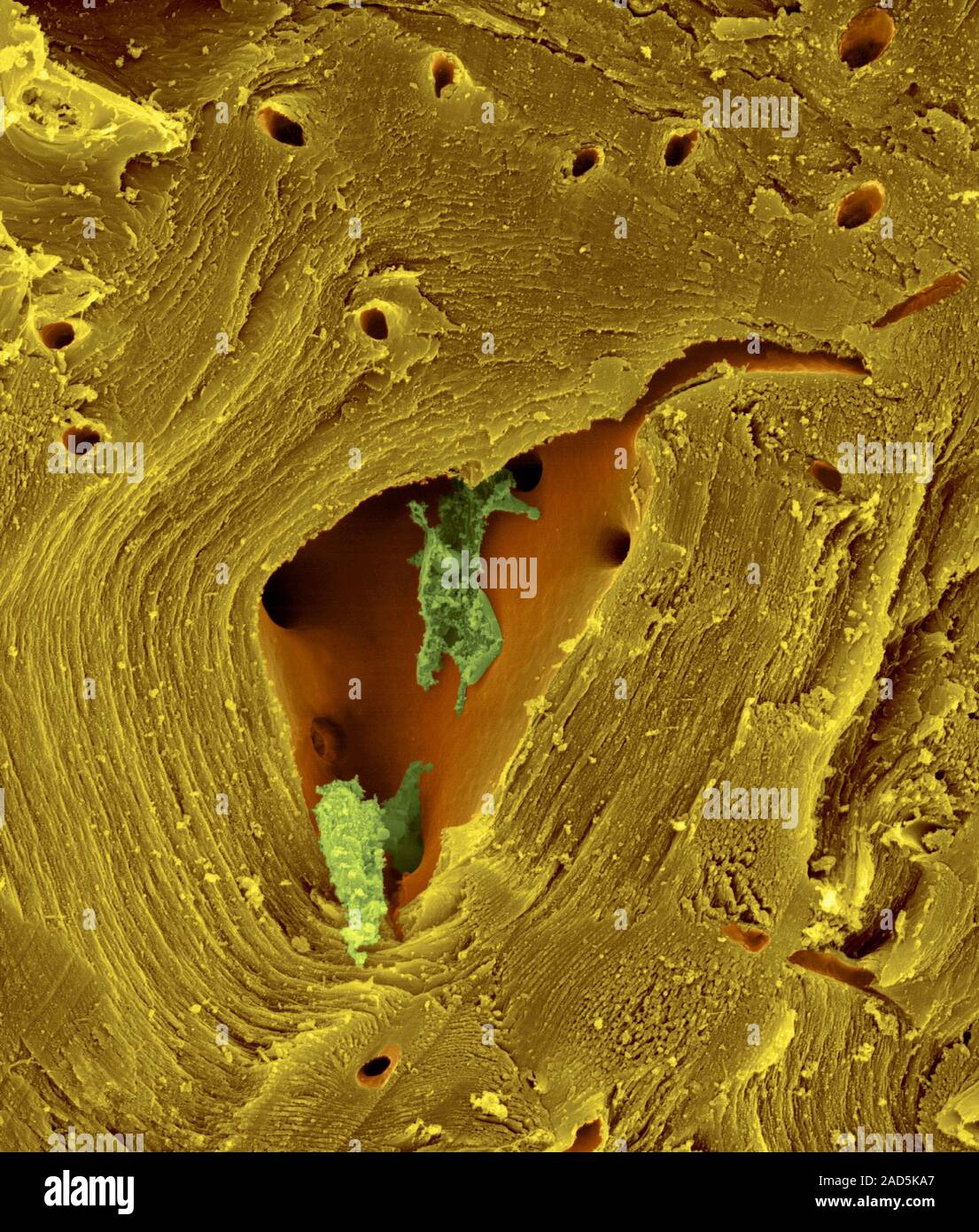 Pear fruit (Pyrus sp.) sclerenchyma cell, coloured scanning electron ...
