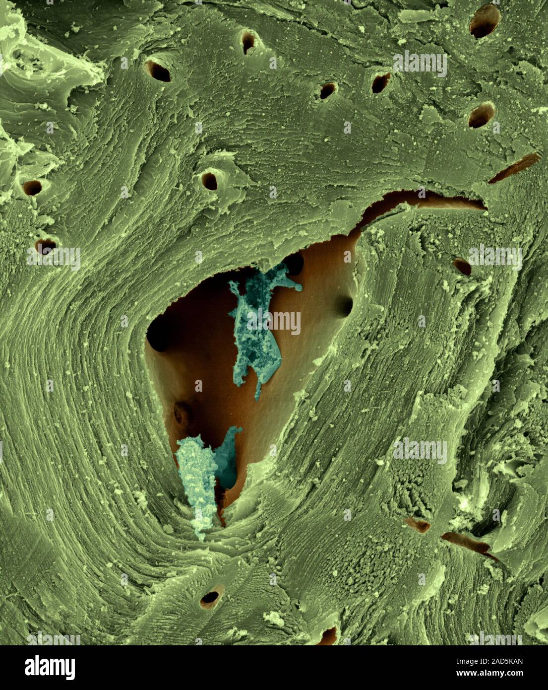 Pear fruit (Pyrus sp.) sclerenchyma cell, coloured scanning electron ...