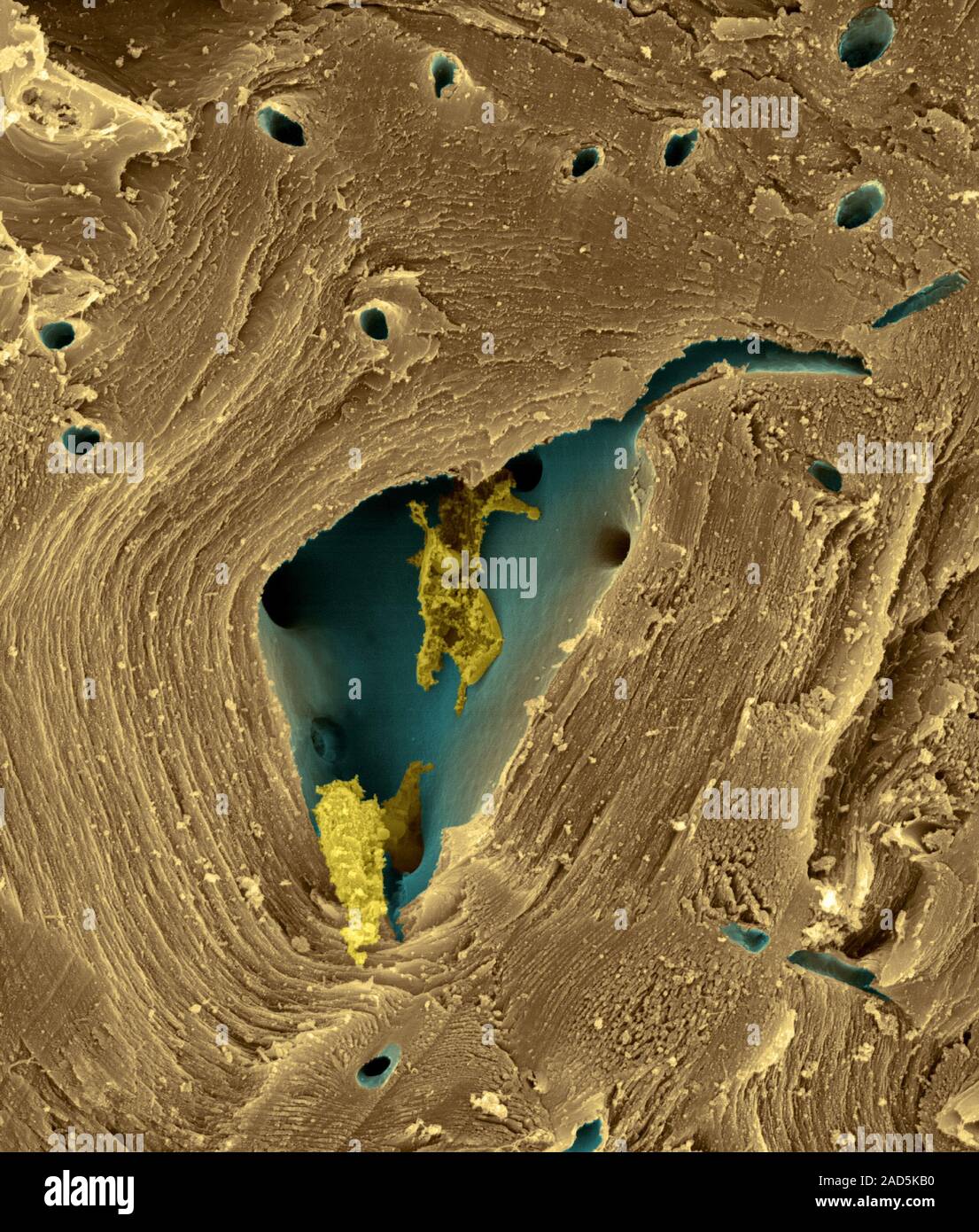 Pear fruit (Pyrus sp.) sclerenchyma cell, coloured scanning electron ...