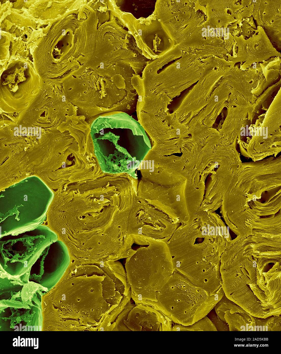 Pear fruit (Pyrus sp.) sclerenchyma cells, coloured scanning electron ...