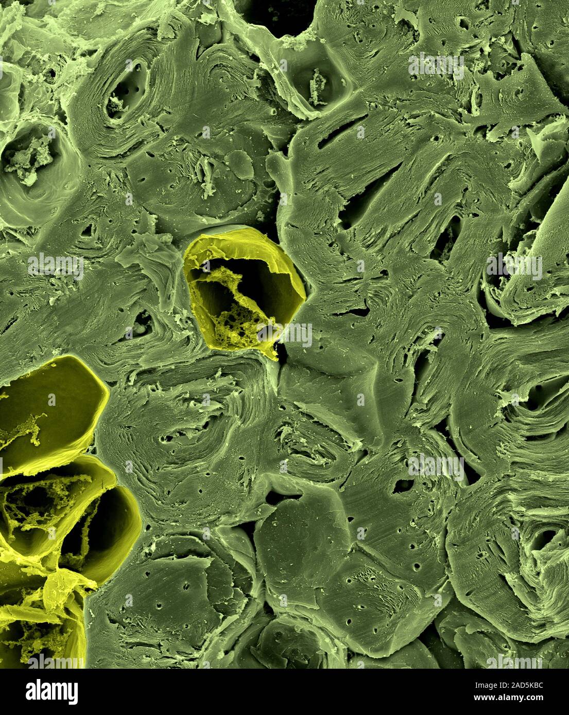 Pear fruit (Pyrus sp.) sclerenchyma cells, coloured scanning electron ...