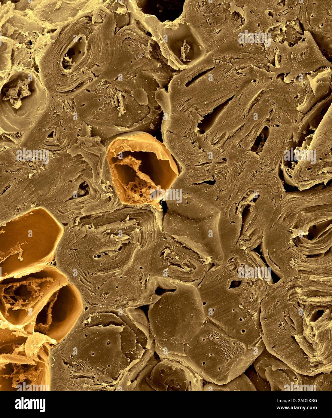 Pear fruit (Pyrus sp.) sclerenchyma cells, coloured scanning electron ...