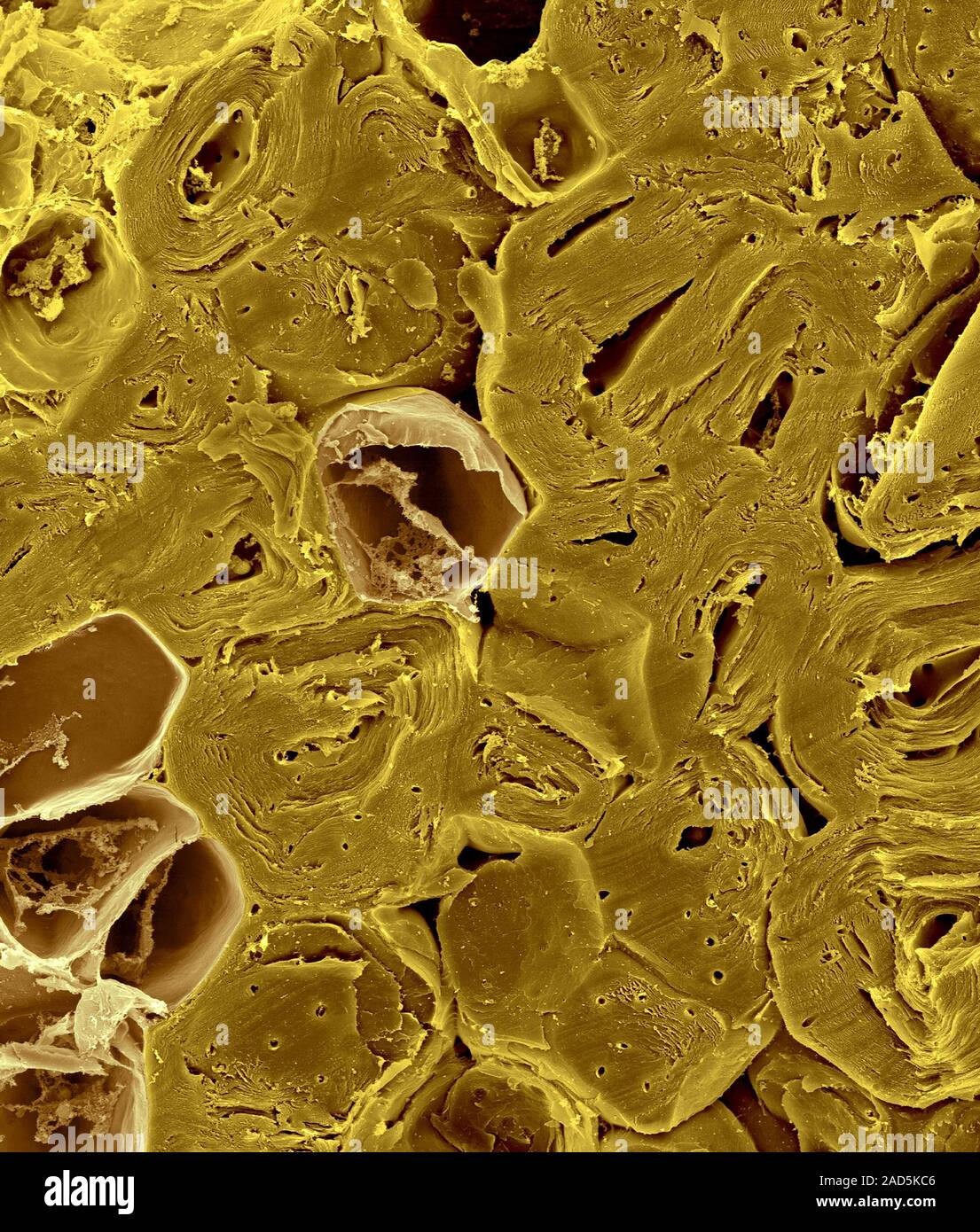 Pear fruit (Pyrus sp.) sclerenchyma cells, coloured scanning electron ...