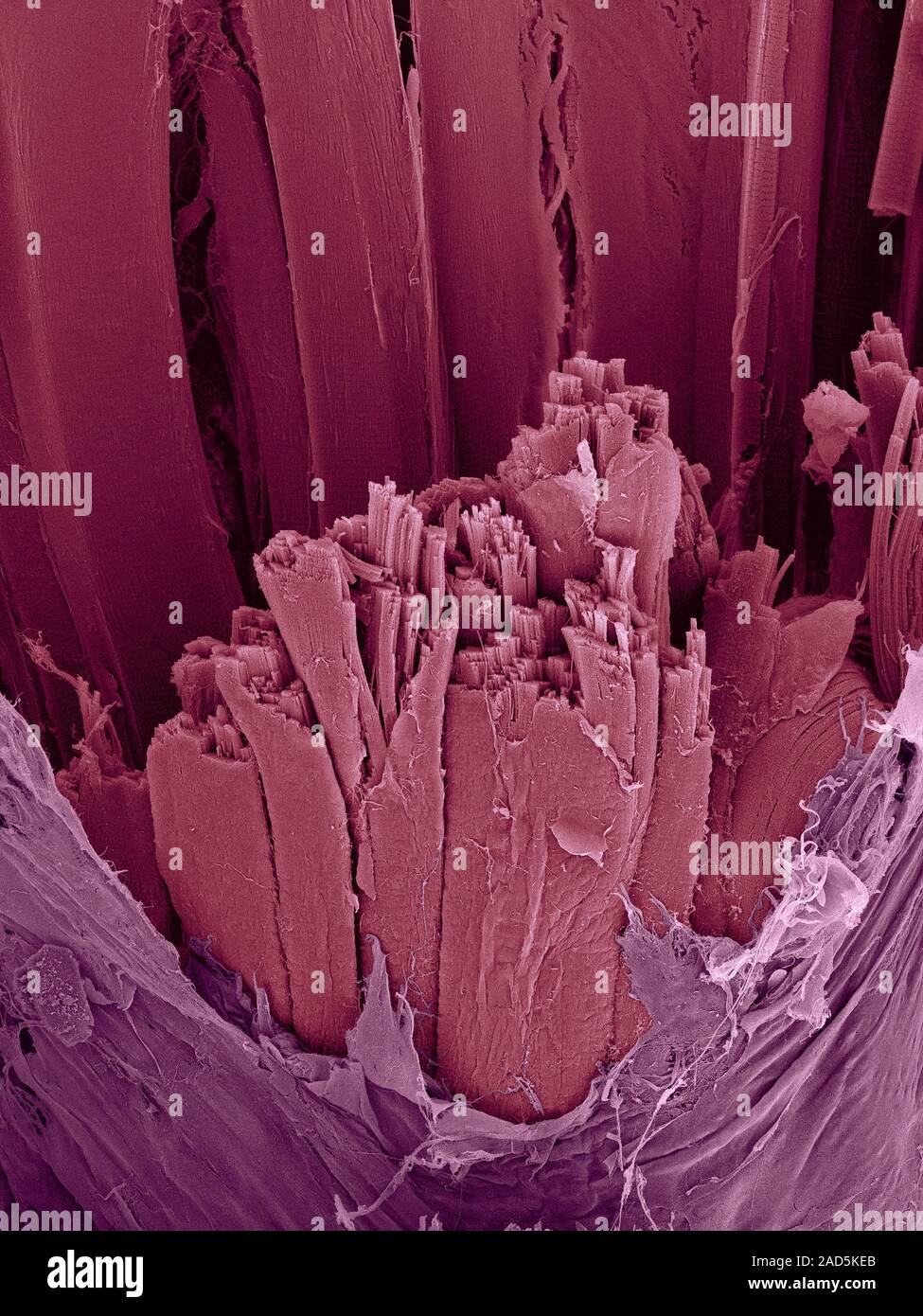Coloured scanning electron micrograph (SEM) Frog skeletal leg muscle fibres with exposed ...