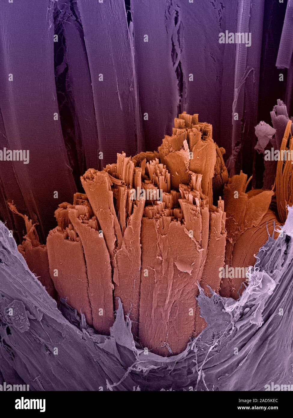 Coloured scanning electron micrograph (SEM) Frog skeletal leg muscle ...