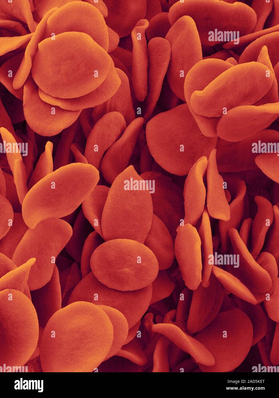 Coloured scanning electron micrograph (SEM) Frog blood (coqui ...