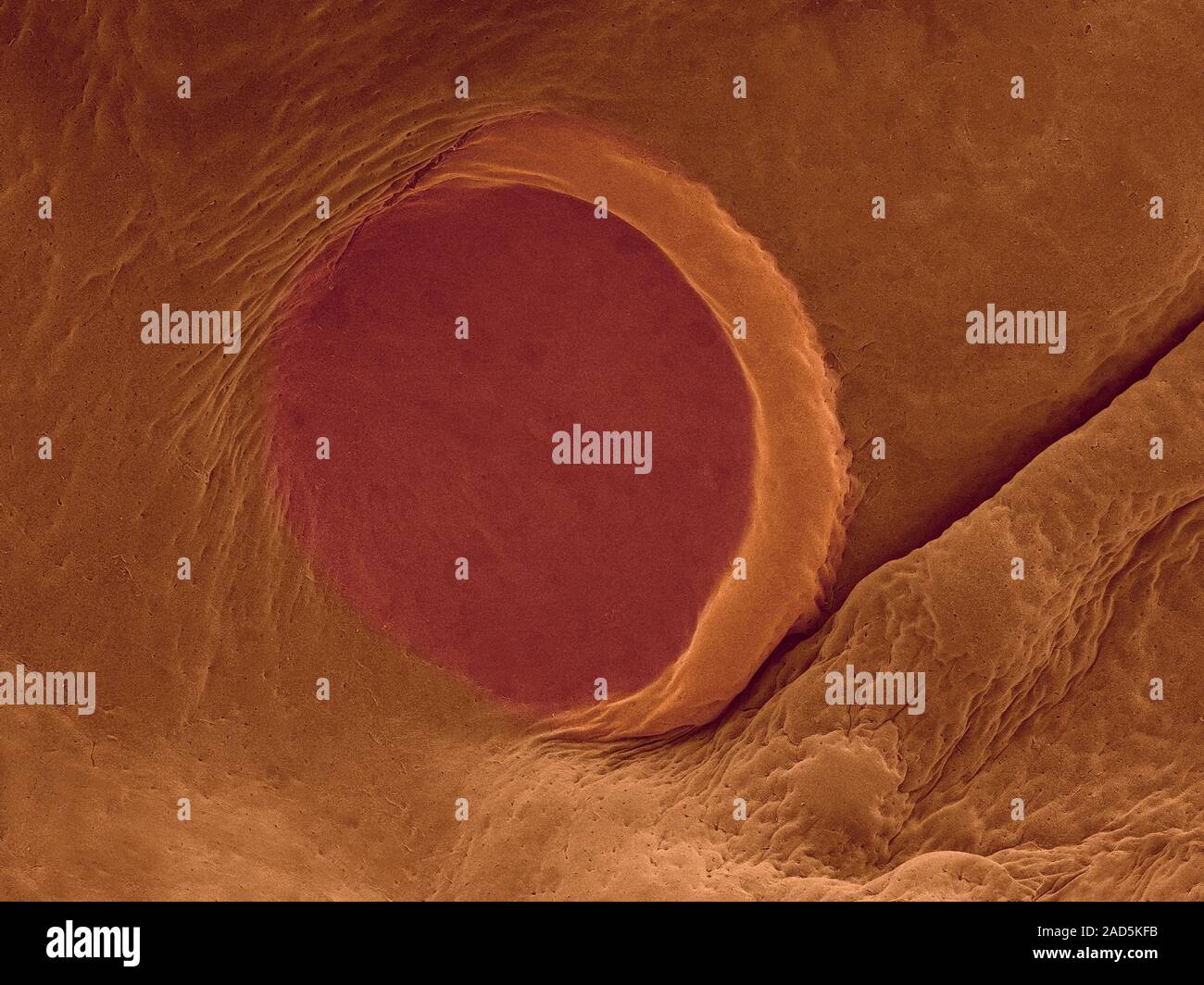 Coloured scanning electron micrograph (SEM) Frog tympanic membrane ...