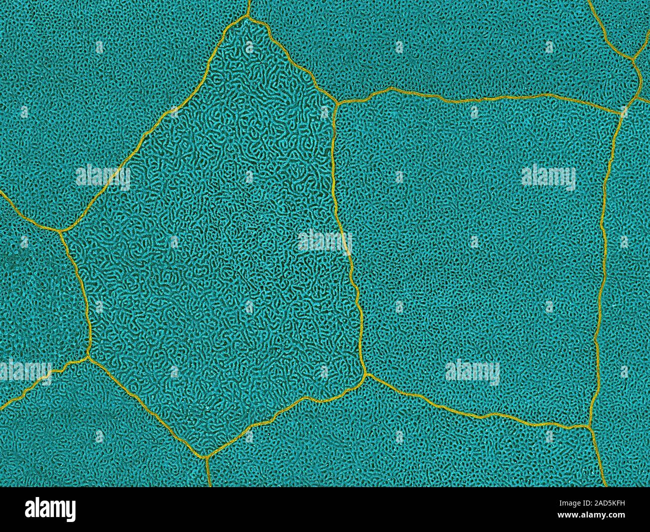 Coloured scanning electron micrograph (SEM) Frog tympanic membrane cell ...