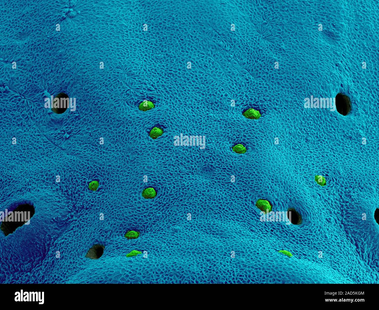 Coloured scanning electron micrograph (SEM) Convict cichlid fish skin ...