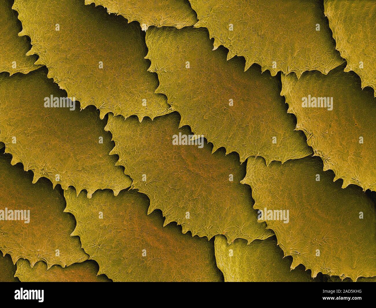 Coloured scanning electron micrograph (SEM) Convict cichlid fish scales ...