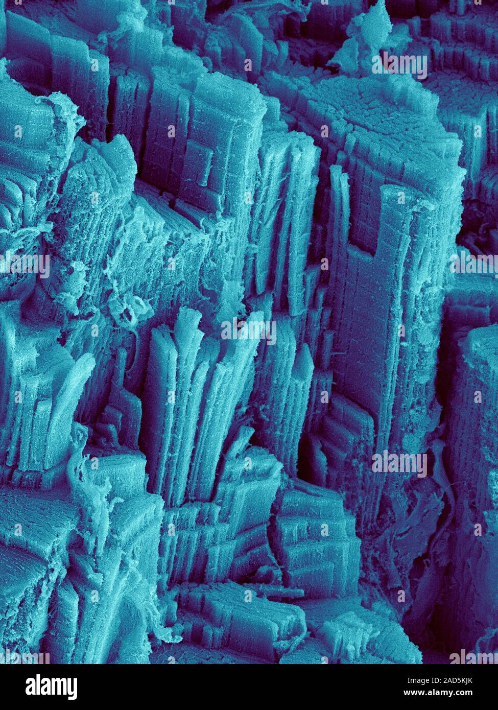 Coloured scanning electron micrograph (SEM) Goby fish skeletal muscle ...