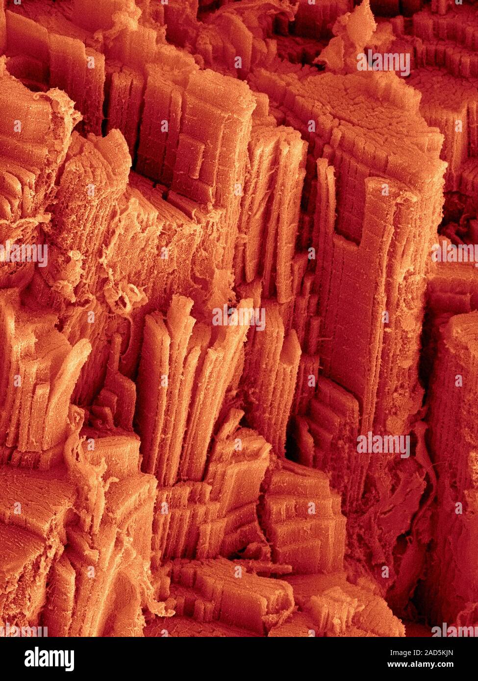 Coloured scanning electron micrograph (SEM) Goby fish skeletal muscle ...