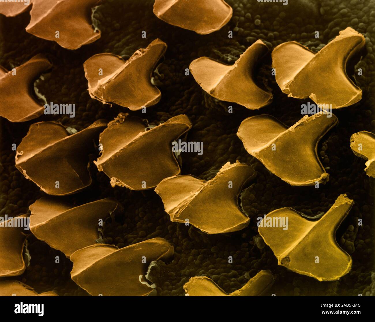 Coloured scanning electron micrograph (SEM) Dogfish (shark) denticles ...