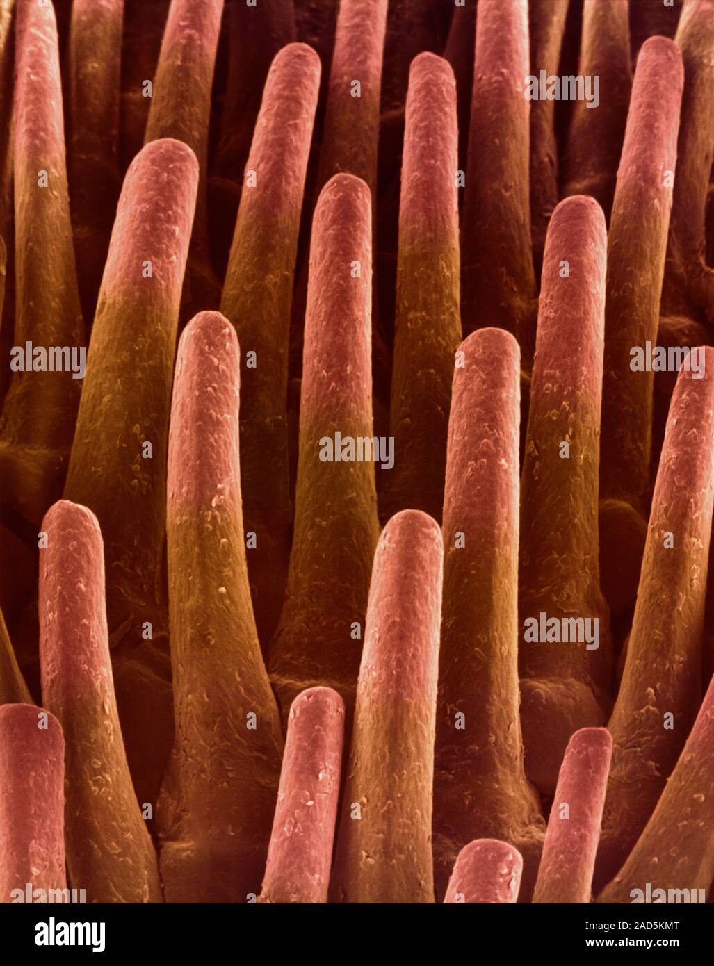 Coloured scanning electron micrograph (SEM) Mammal tongue filiform ...