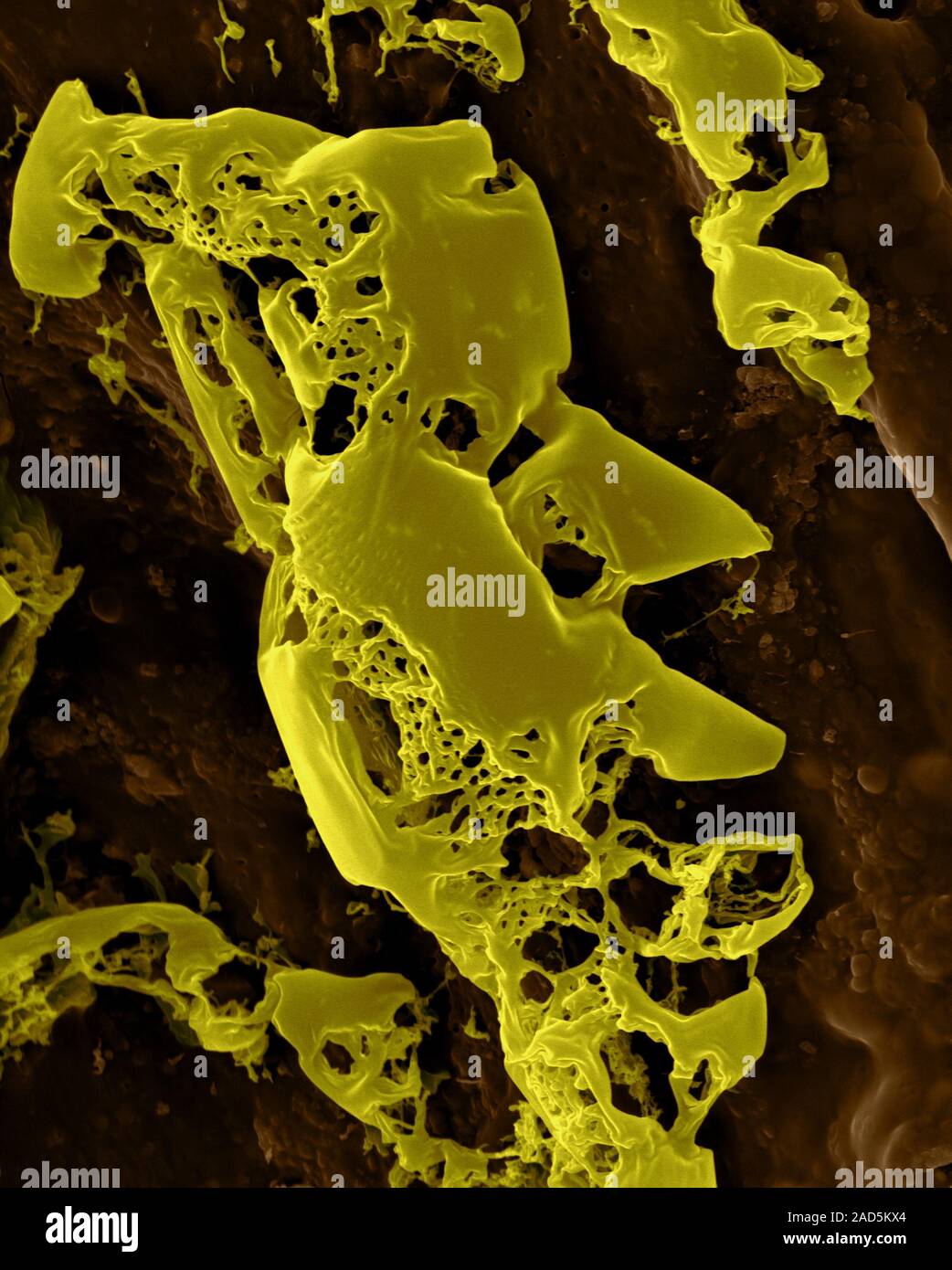 Coloured scanning electron micrograph (SEM) of Sulphur crystals from a ...