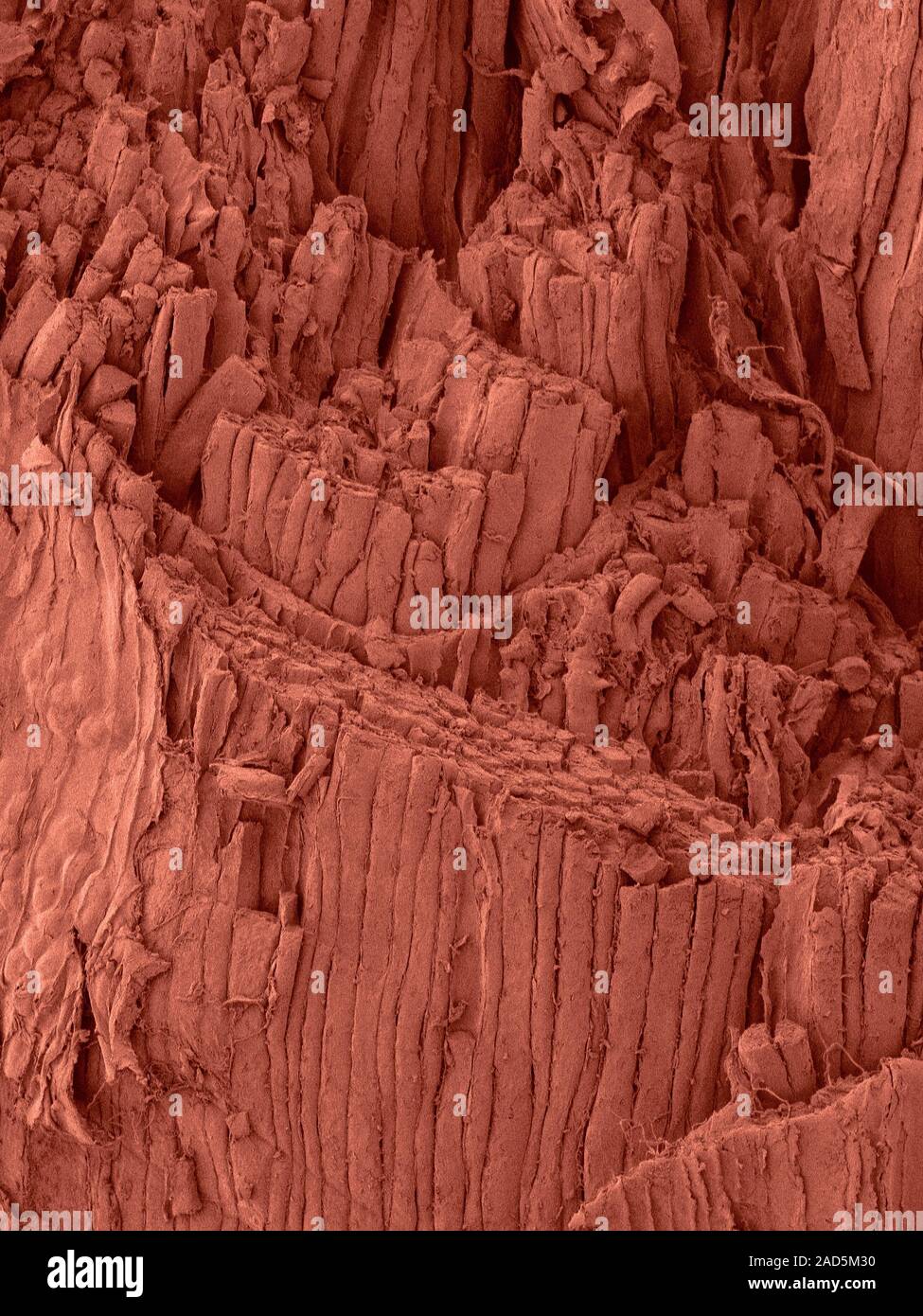 Coloured scanning electron micrograph (SEM) of Ham (pork) shank muscle ...