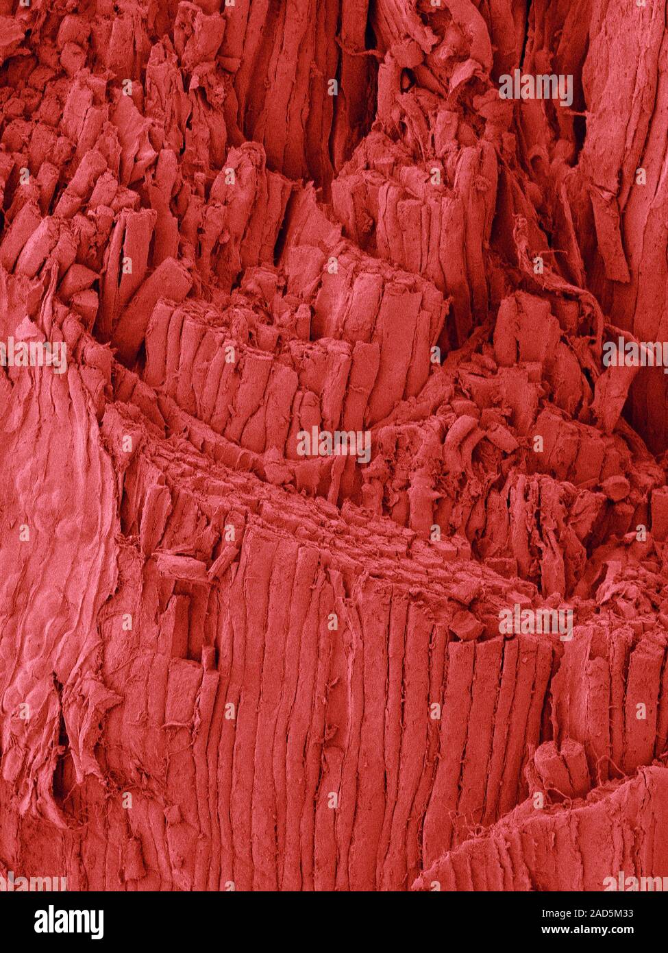 Coloured scanning electron micrograph (SEM) of Ham (pork) shank muscle ...