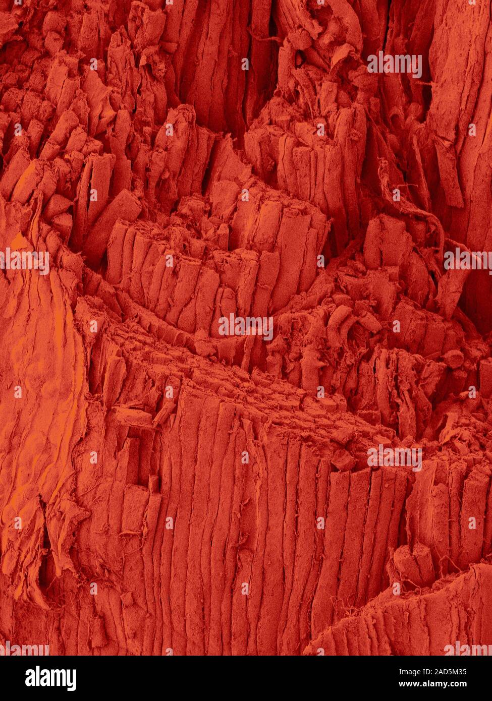 Coloured scanning electron micrograph (SEM) of Ham (pork) shank muscle ...