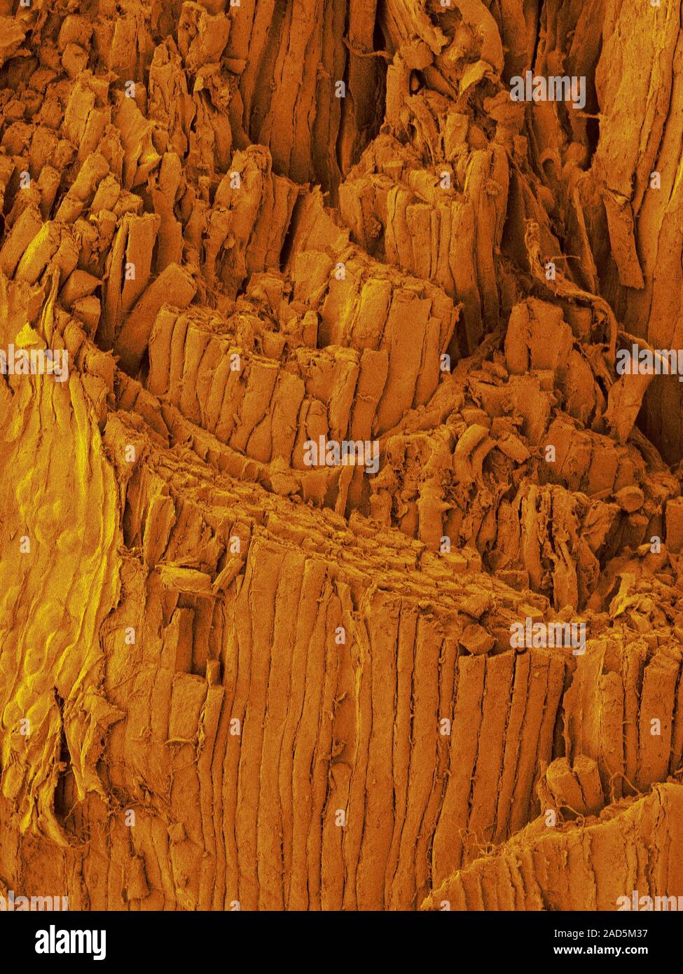 Coloured scanning electron micrograph (SEM) of Ham (pork) shank muscle ...