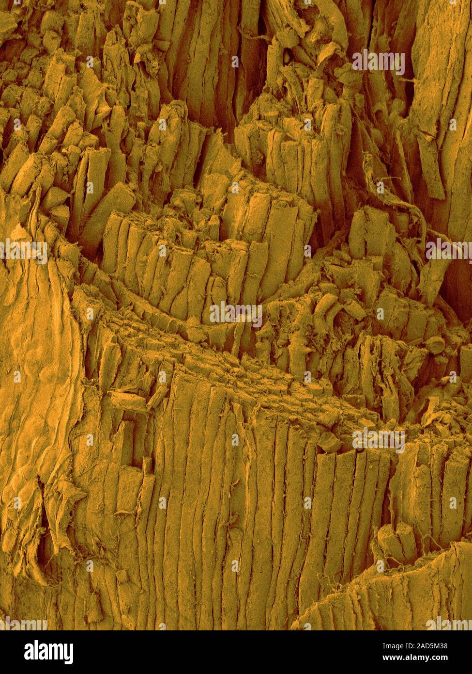 Coloured scanning electron micrograph (SEM) of Ham (pork) shank muscle ...