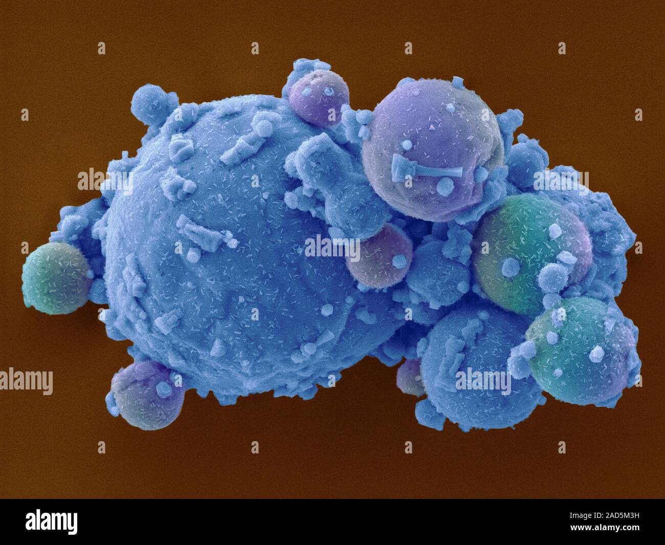 Coloured scanning electron micrograph (SEM) of Aluminium (metal ...