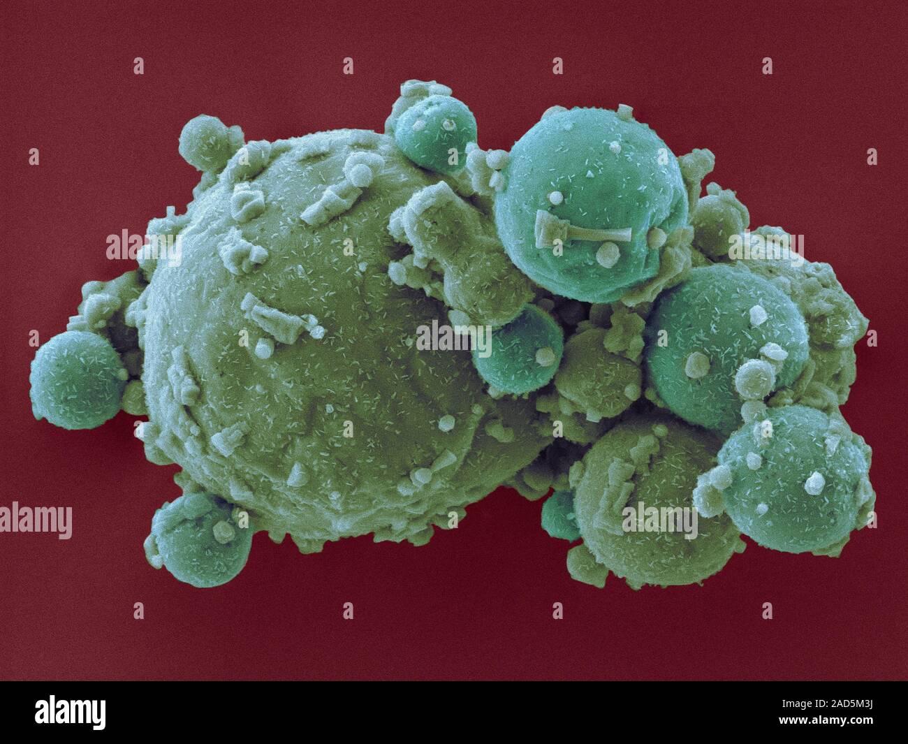 Coloured scanning electron micrograph (SEM) of Aluminium (metal ...