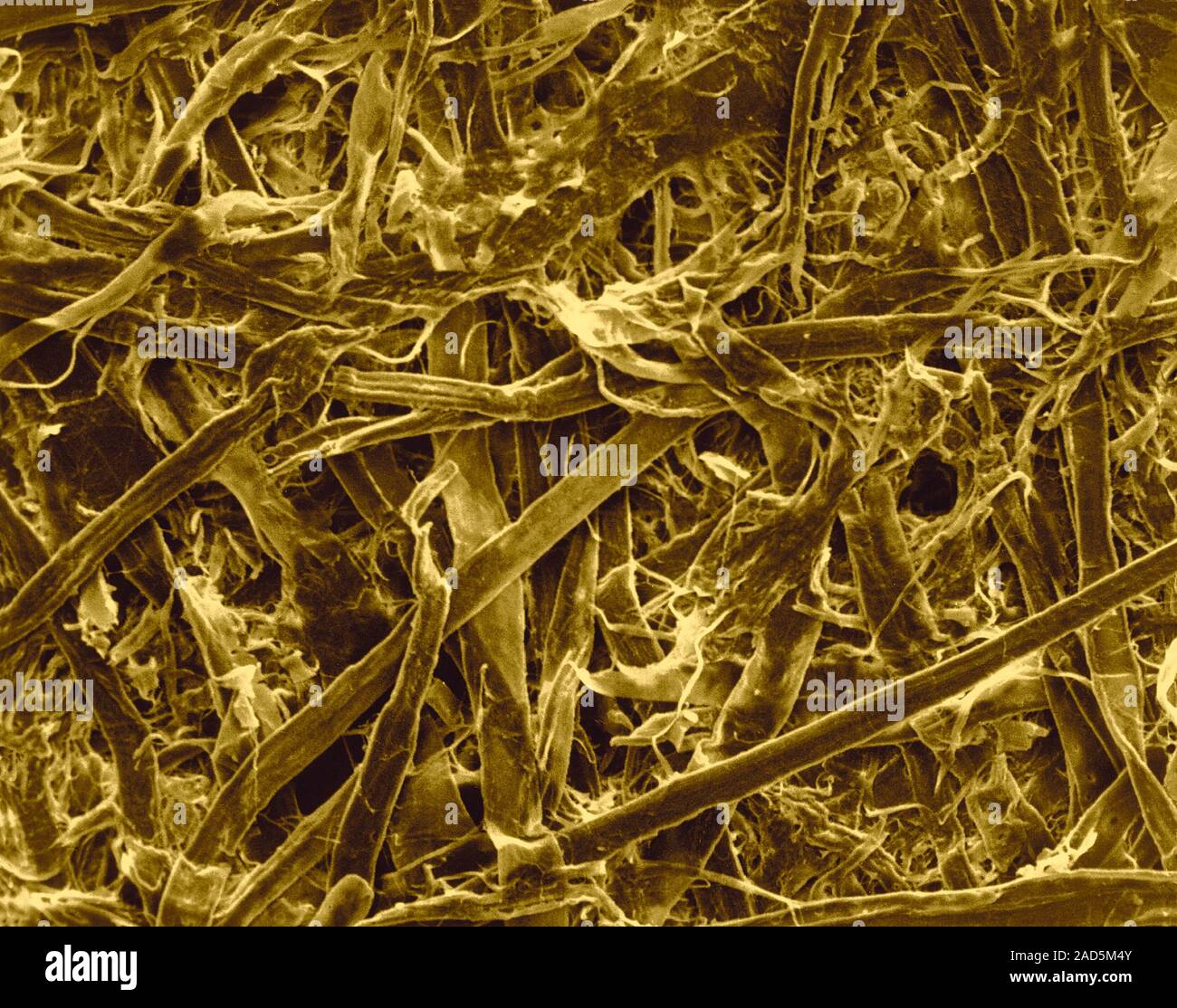 Coloured scanning electron micrograph (SEM) of Cellulose fibres in a ...