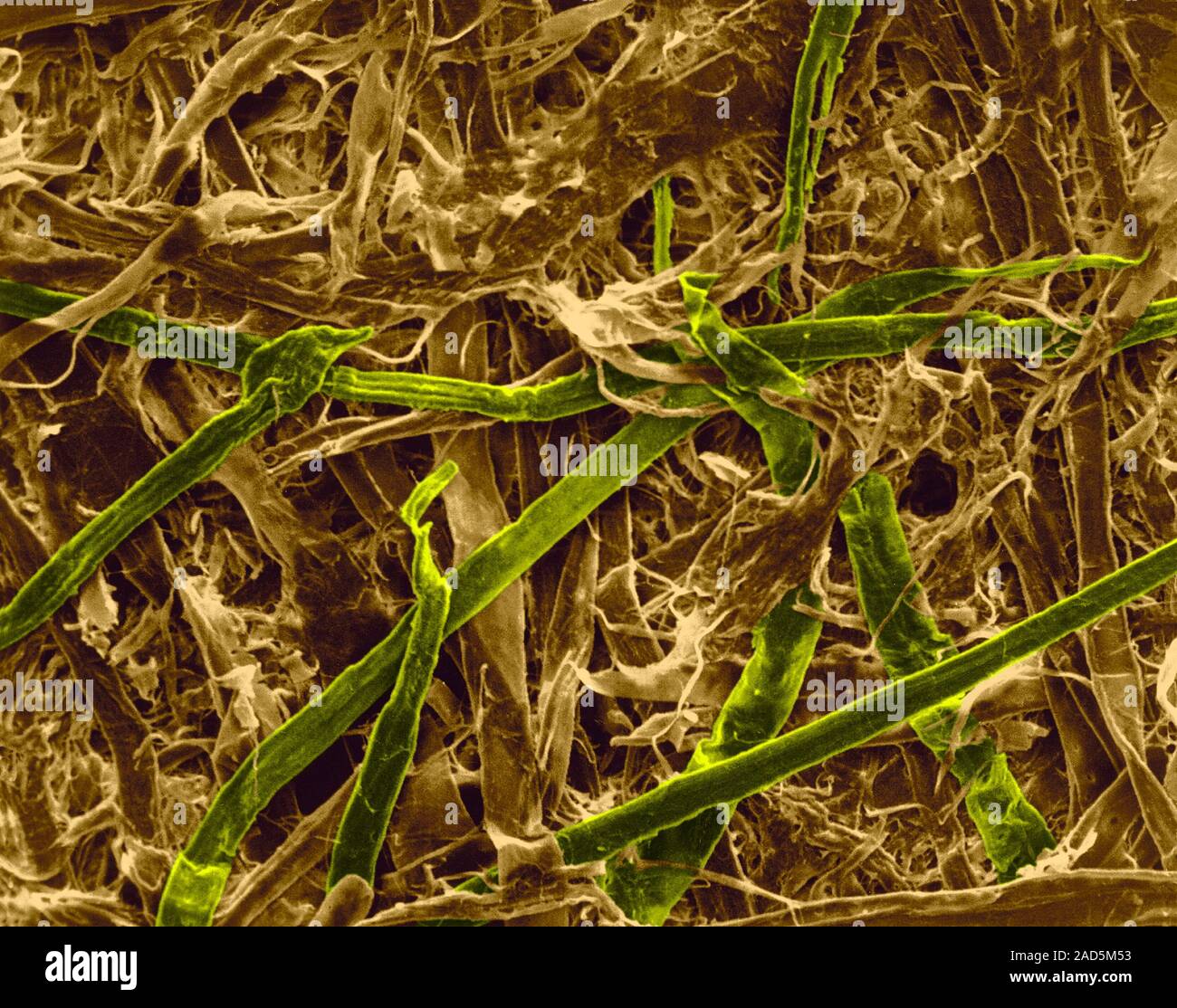 Coloured scanning electron micrograph (SEM) of Cellulose fibres in a ...