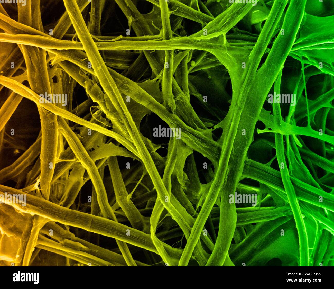 Coloured scanning electron micrograph (SEM) of Indian print paper ...