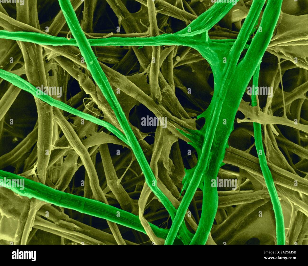 Coloured scanning electron micrograph (SEM) of Indian print paper ...