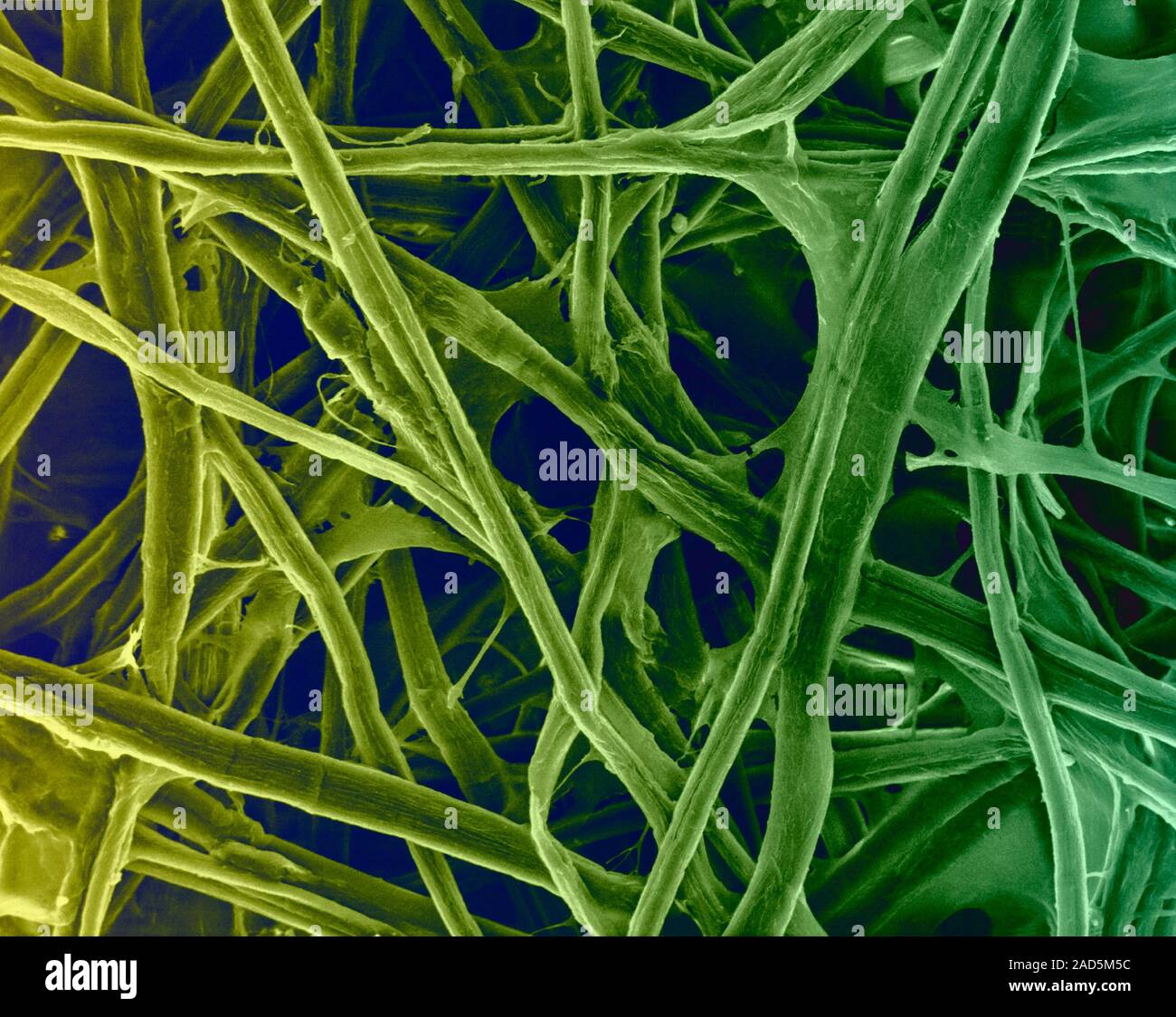 Coloured scanning electron micrograph (SEM) of Indian print paper ...