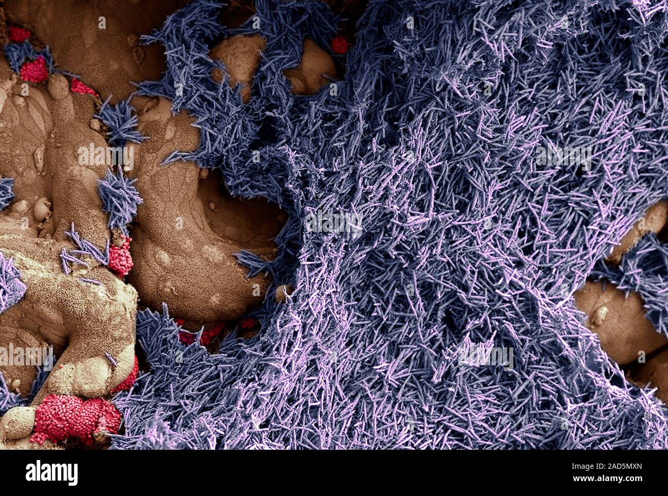Citrobacter rodentium-infected mouse colon. Coloured scanning electron ...