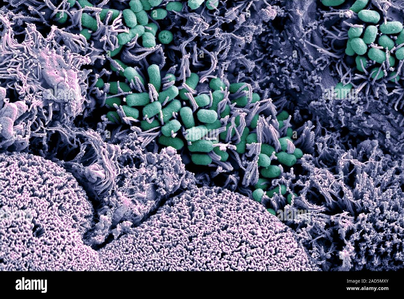 EHEC bacteria on small intestine tissue. Coloured scanning electron ...