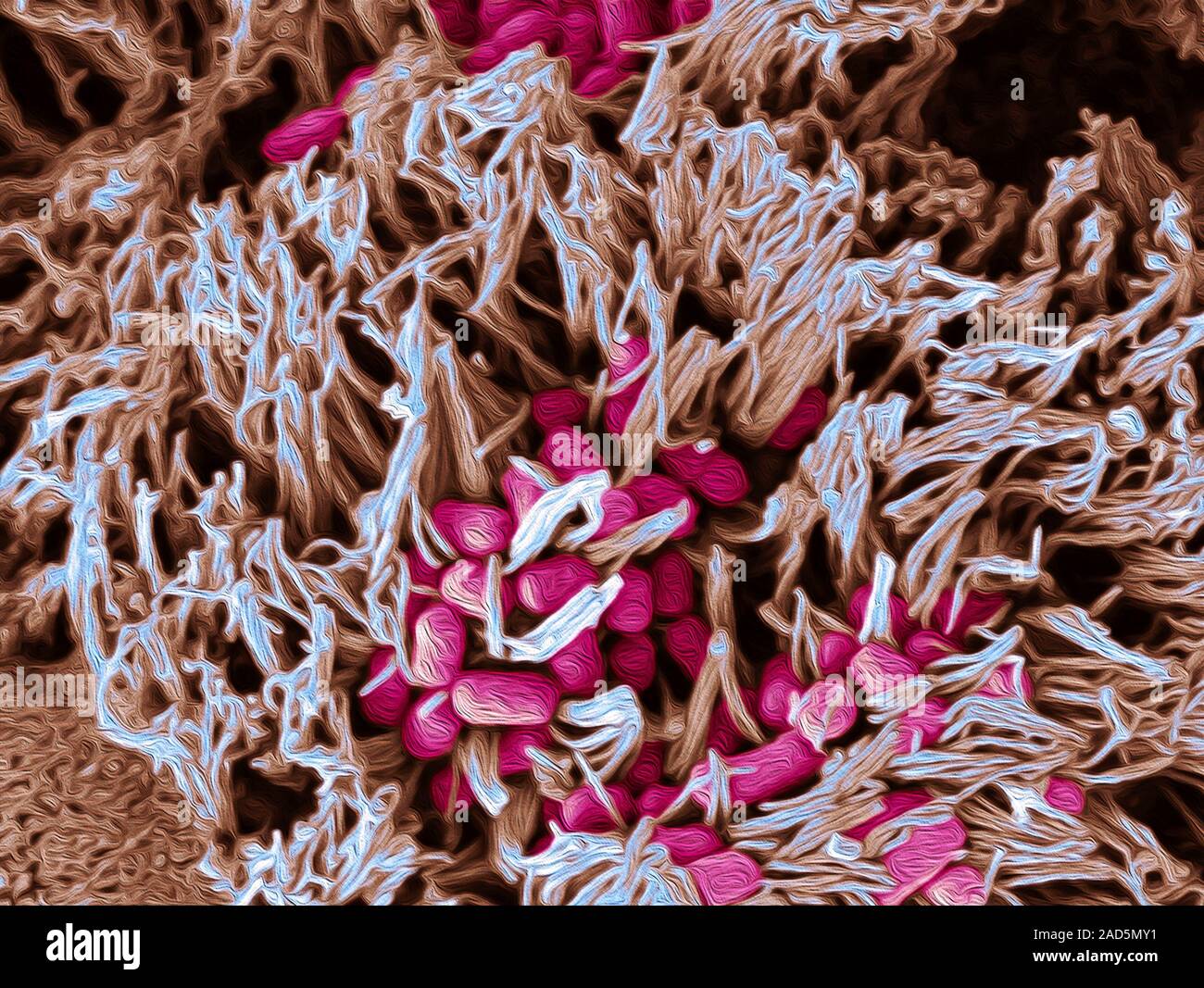 Ehec Bacteria On Small Intestine Tissue Coloured Scanning Electron Micrograph Sem Of Human