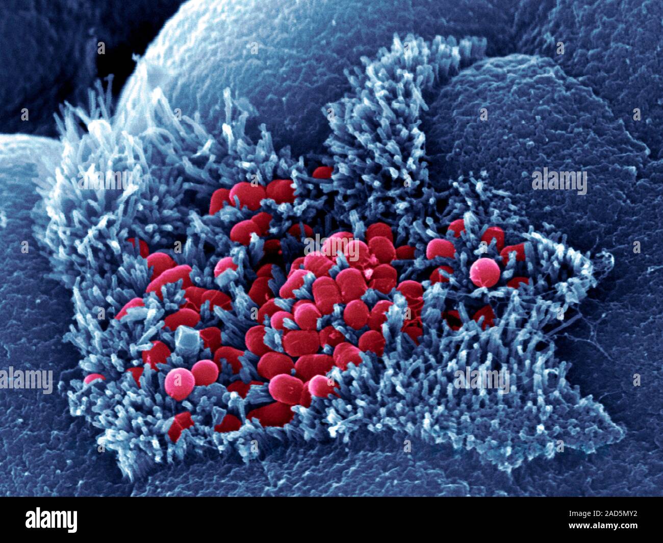 EPEC bacteria on small intestine tissue. Coloured scanning electron ...