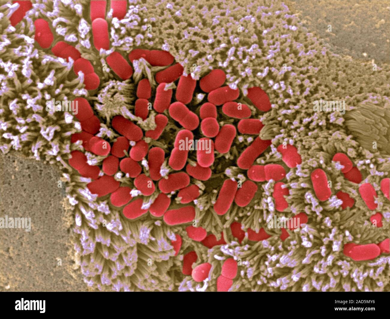 EPEC bacteria on small intestine tissue. Coloured scanning electron ...