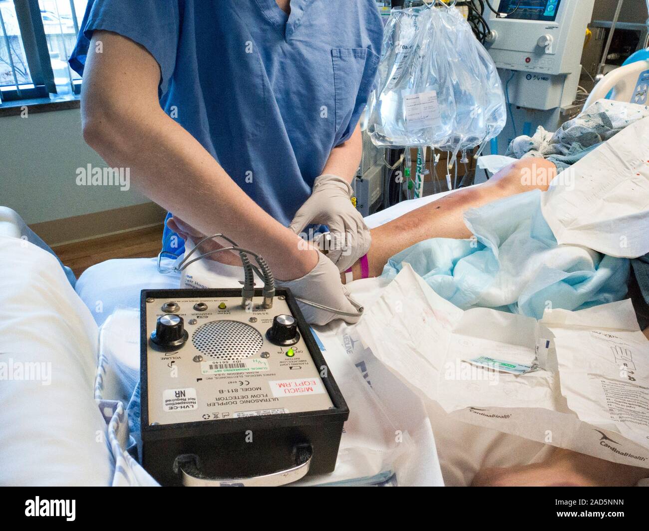 Doppler ultrasound blood flow test. Doctor using a Doppler ultrasound ...
