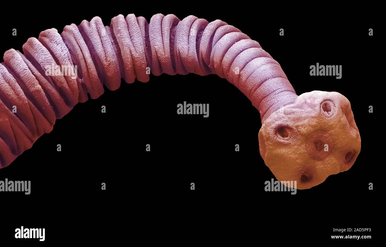Tapeworm metacestode. Scanning electron micrograph (SEM) of the bladder ...