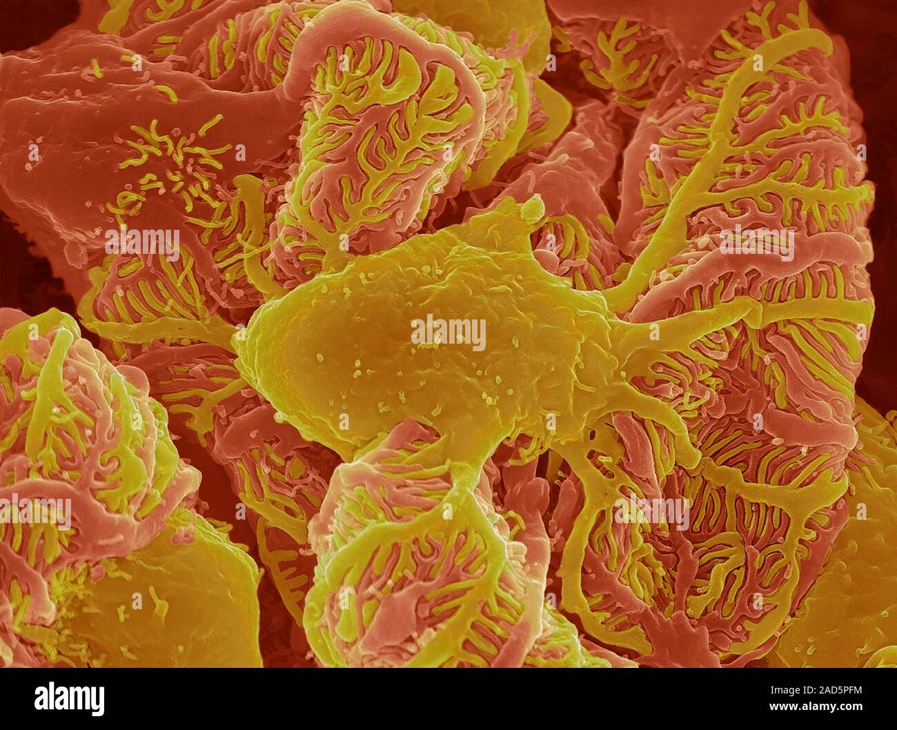 Kidney glomerulus. Coloured scanning electron micrograph (SEM) of ...