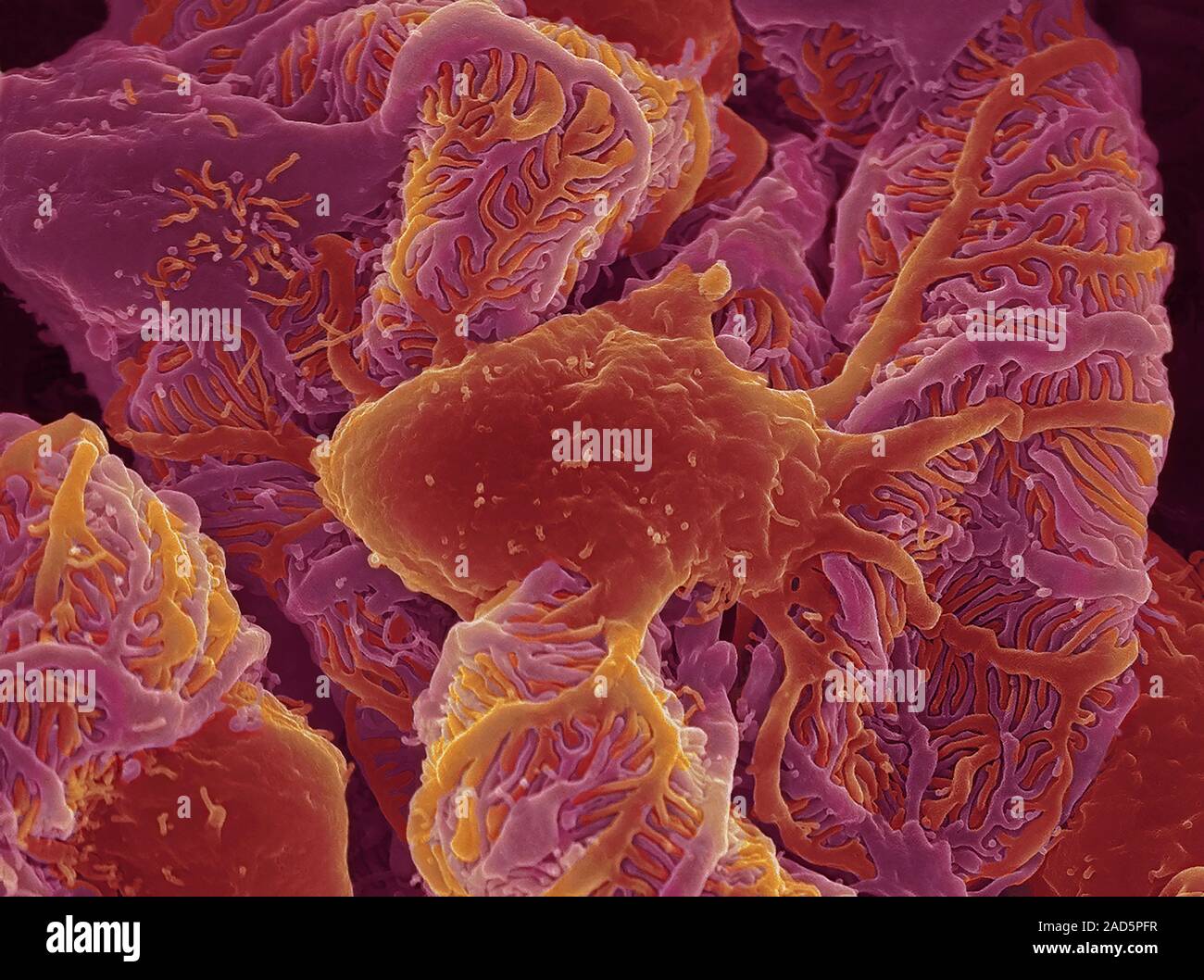 Kidney glomerulus. Coloured scanning electron micrograph (SEM) of ...