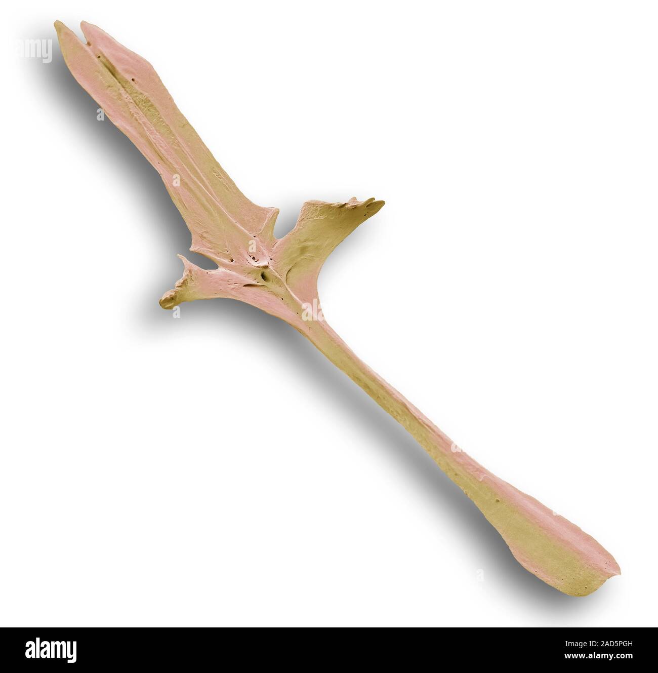 Coloured scanning electron micrograph (SEM) of the parasphenoid bone ...