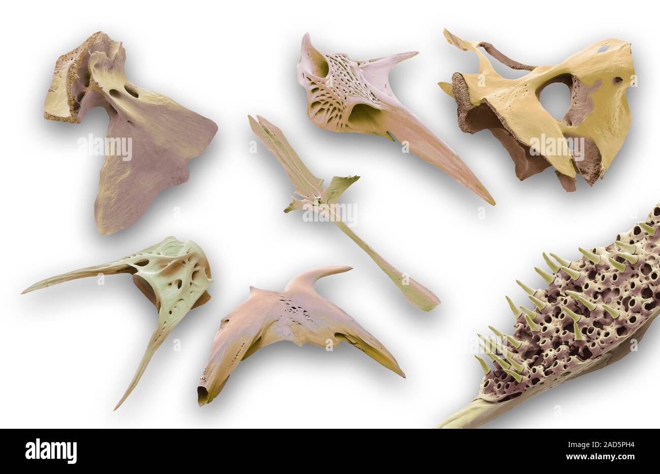 Coloured scanning electron micrograph (SEM) of bones from a fish ...